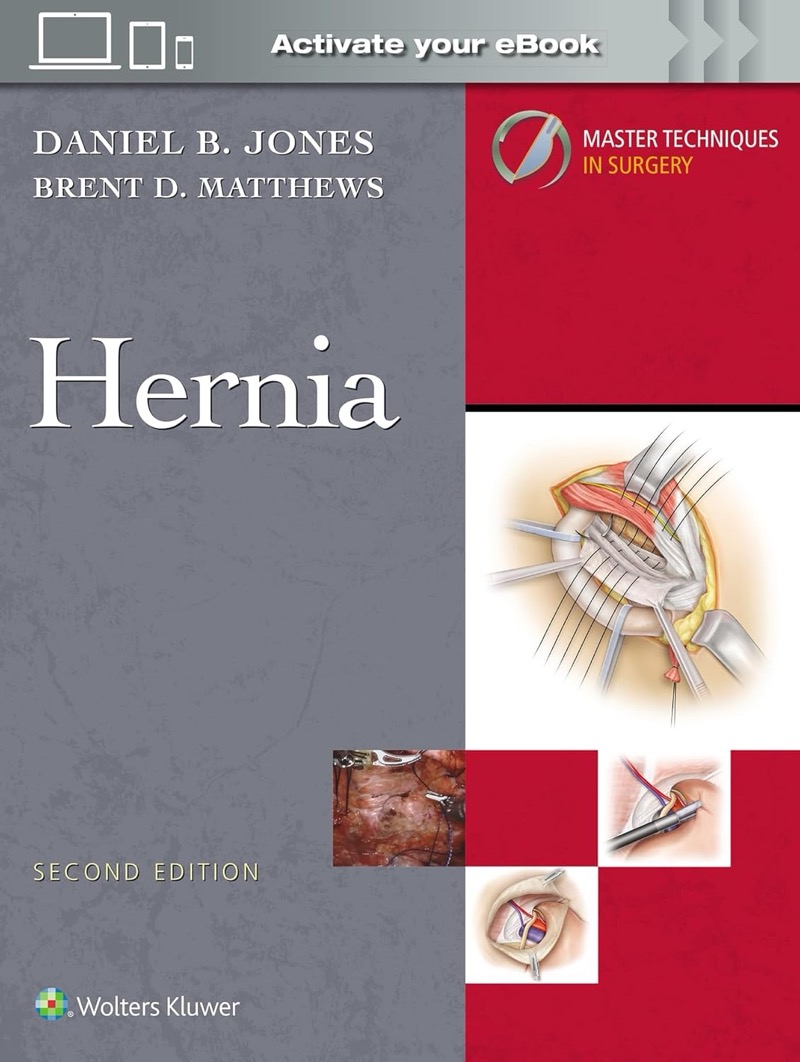 Jones - Matthews Master Techniques in Surgery: Hernia - With Online ...